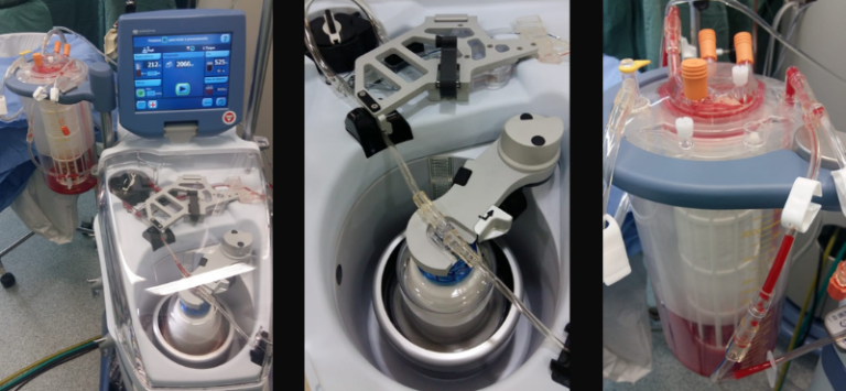 LivaNova: medical innovation known to the public - Art Presse